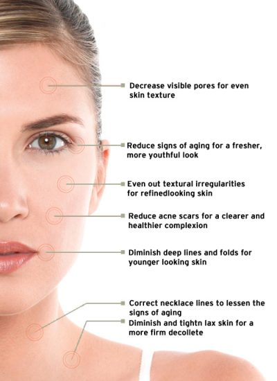 Venus Viva Non-Surgical Skin Treatment | Barr Aesthetics