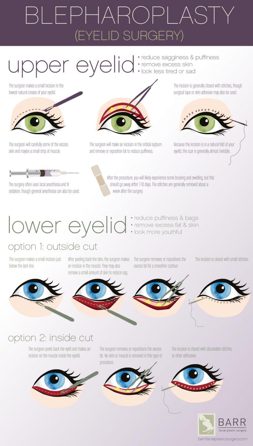Eyelid Procedure Barr Aesthetics